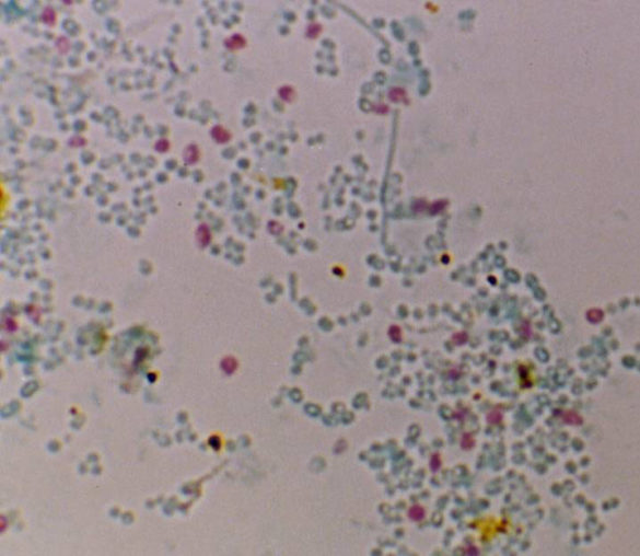 Microsporidia - Milenia Biotec