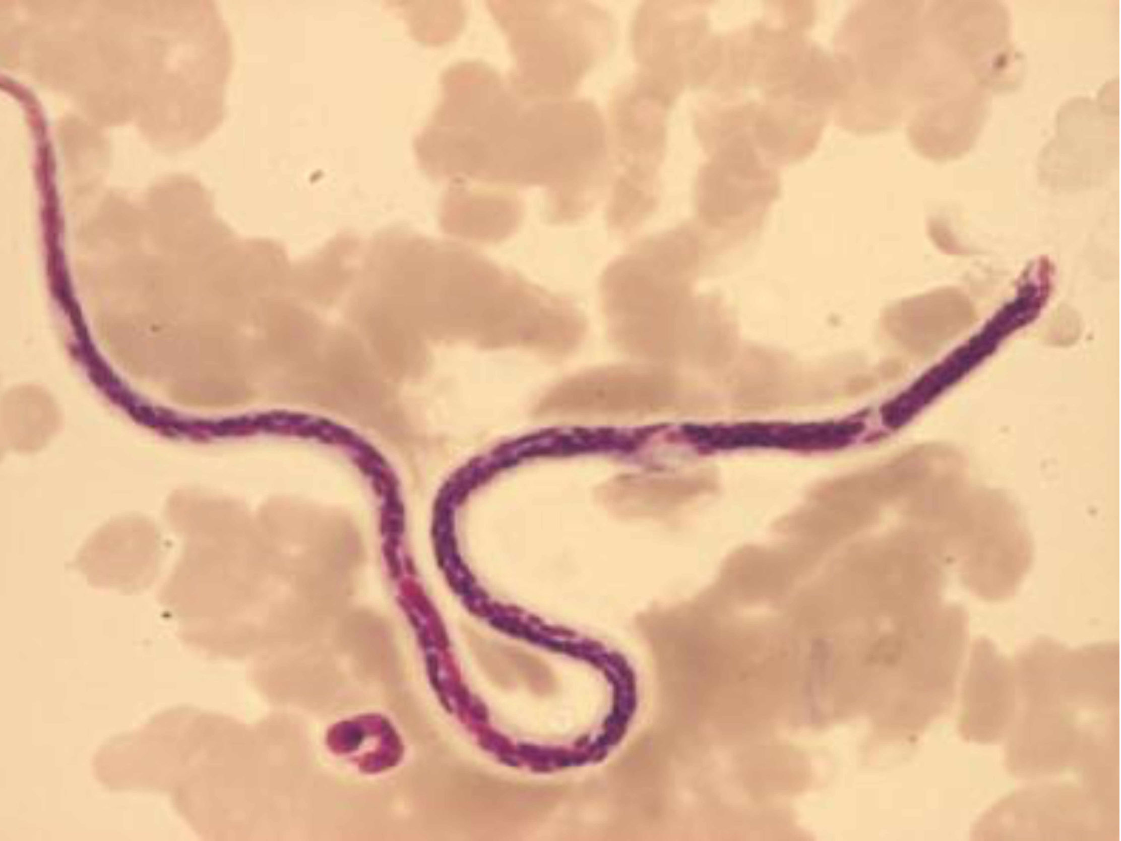 Acanthocheilonema viteae - IgG - Milenia Biotec