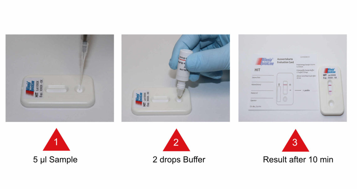 HIT Control - Milenia Biotec