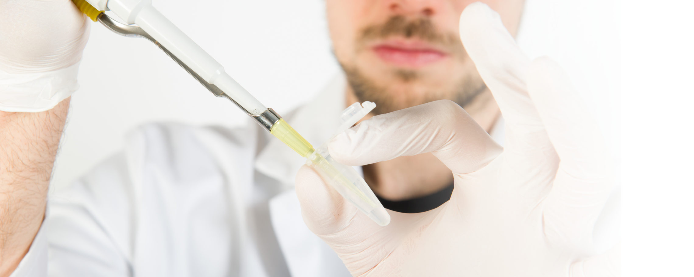 How to Overcome Contamination in Amplification Assays » Check