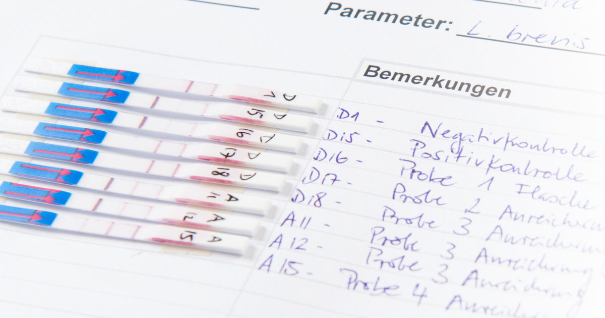 Loop Mediated Isothermal Amplification (LAMP) - Lateral Flow