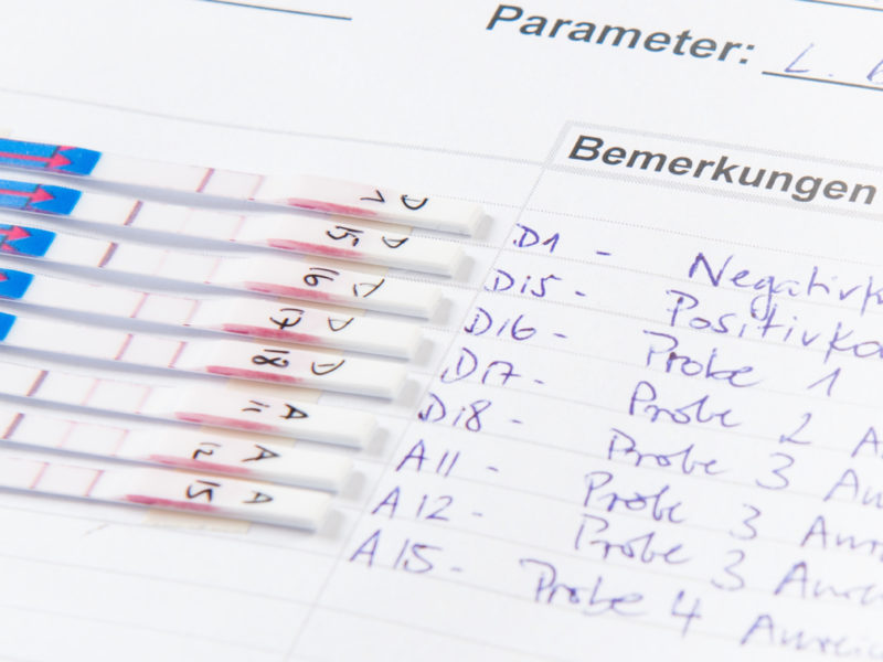 Loop mediated isothermal Amplification & Lateral Flow
